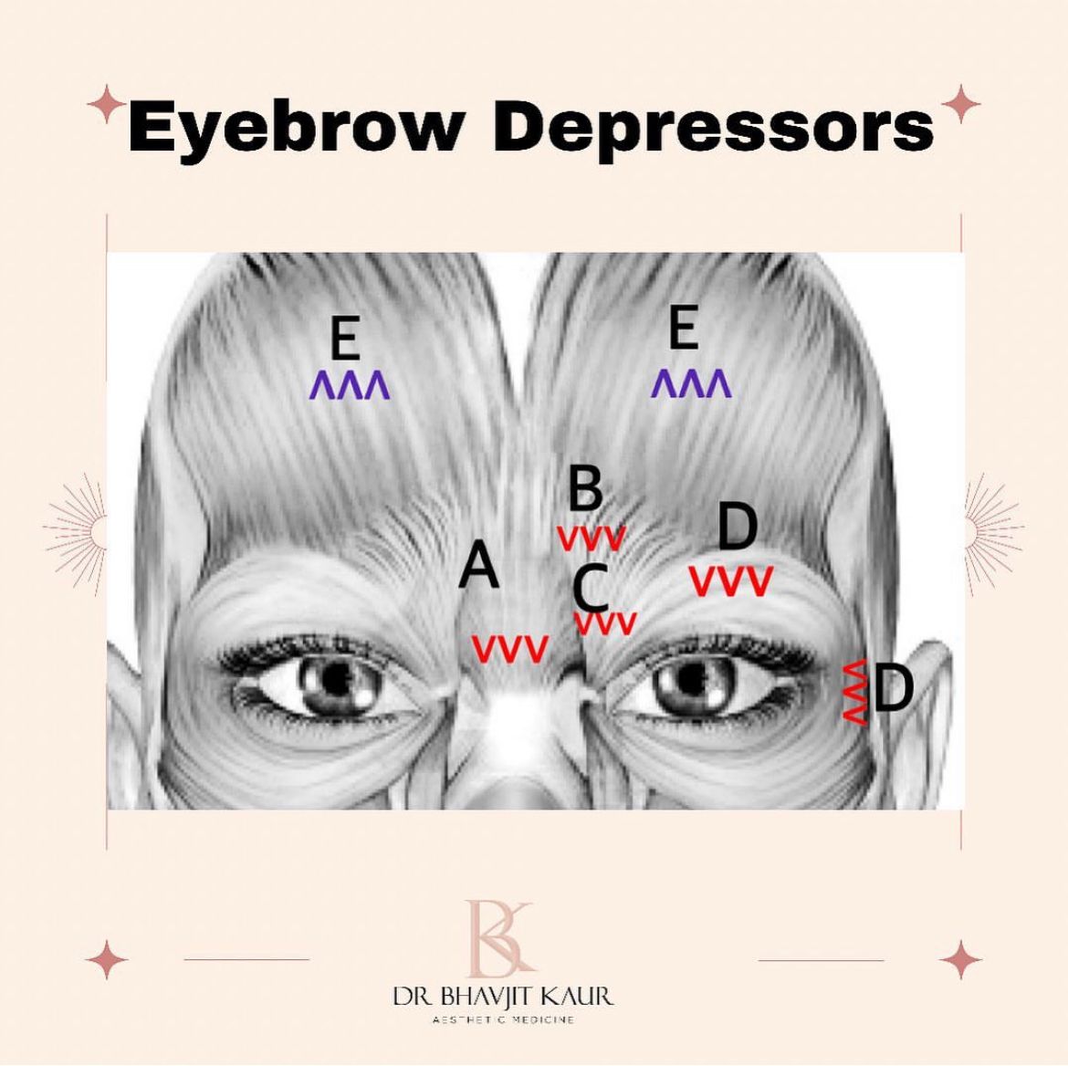 Explaining the Eyebrow Lift - Dr Bhavjit Kaur